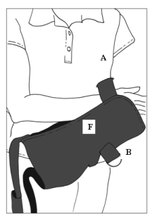 How To Apply A Sling, Orthosports Orthopaedic Surgeons