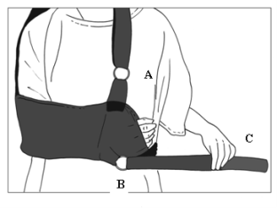How To Apply A Sling, Orthosports Orthopaedic Surgeons