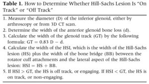 Glenoid Track and Shoulder Instability - Orthosports