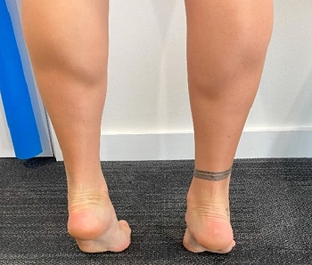 Question for Physiotherapists - Orthosports